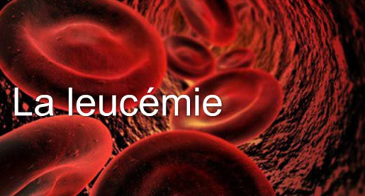 Leucémie Cancer du Sang Traitement Naturel efficace